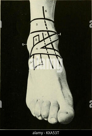 "Landmarks and surface markings of the human body" (1913 Stock Photo ...