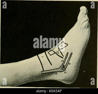 "Landmarks and surface markings of the human body" (1913 Stock Photo ...