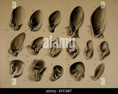 An anatomical illustration showing the cartilage and outer ear ...