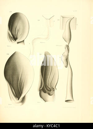 An anatomical illustration showing the cartilage and outer ear ...