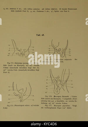 An anatomical illustration showing the cartilage and outer ear ...