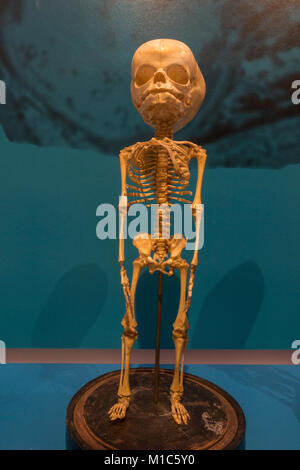Human child fetal skeleton at 9 months on display in the National ...