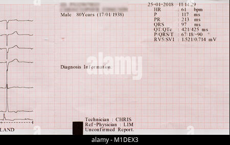 ECG print out Stock Photo - Alamy
