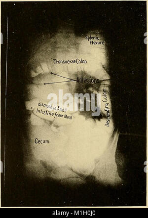 'A Manual of X-ray Technic' (1917) provides a detailed guide on the use ...