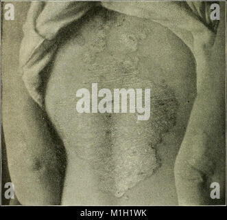 This 1898 textbook provides comprehensive information on genito-urinary ...