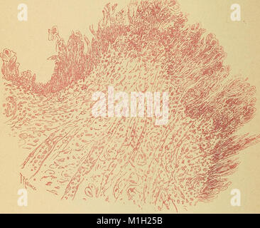 This 1893 medical text provides a comprehensive guide to genito-urinary ...