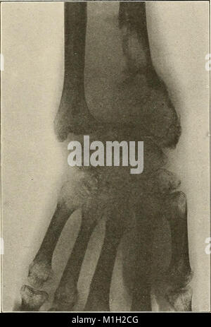 . A radiographic atlas of the pathologic changes of bones and joints ...