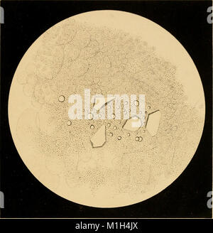 The 1885 Atlas of Clinical Microscopy provides detailed illustrations ...