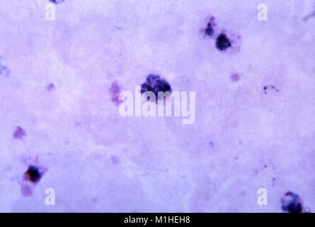Photomicrograph of the malaria parasite Plasmodium vivax in trophozoite ...
