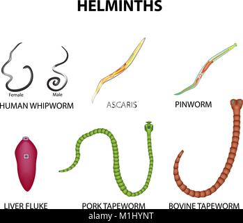 Whipworm.Infographics. Vector illustration on isolated background Stock ...