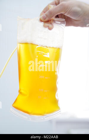 procedure plasmapheresis - the procedure of purification of blood and ...