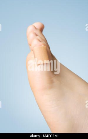 A close up of the adhesive 'sticky' toe pads characteristic of tree ...