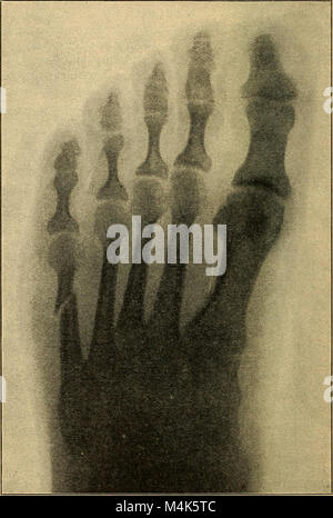 This 1902 medical atlas provides an in-depth examination of traumatic ...