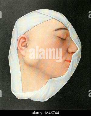 . Atlas of clinical surgery; with special reference to diagnosis and ...