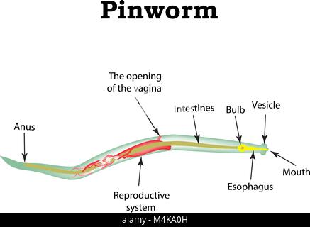 Pinworm or Enterobius or Threadworm or seatworm, vintage engraved ...