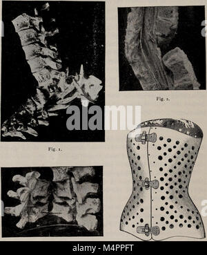 The 'Buffalo Medical Journal' from 1901 presents medical research, case ...