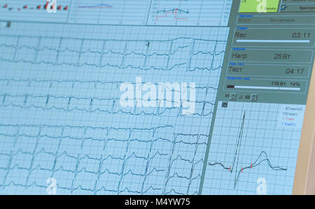 hospital room station ecg Stock Photo - Alamy