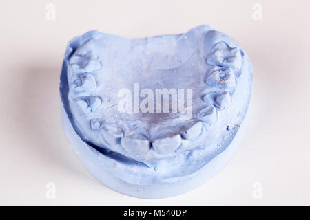 gips model from teeth Stock Photo - Alamy