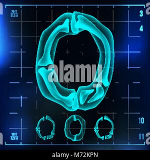 X-ray Font Vector. Transparent Roentgen Alphabet. Radiology 3D Scan ...