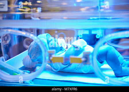 Newborn baby in an incubator with blue light for jaundice in the ...