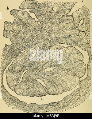 The Cyclopedia of Obstetrics and Gynecology (1887) is a comprehensive ...