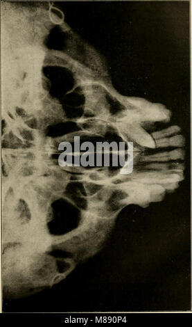 'Elementary and Dental Radiography' (1918) by Howard Riley Raper is an ...