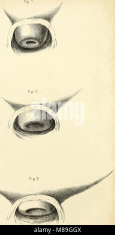 . First lines of the practice of midwifery: to which are added remarks ...