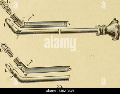 Die Krankheiten der Frauen : für Ärzte und Studierende . 96. Portio mit ...