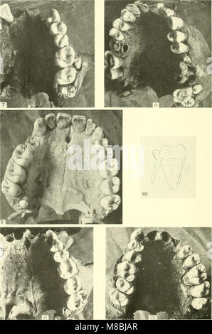 The research discusses dental development in an embryo, with a focus on ...