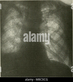 Diseases of the chest and the principles of physical diagnosis . Fig ...