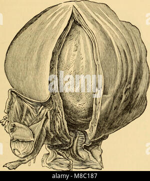 Diseases of women. A clinical guide to their diagnosis and treatment ...