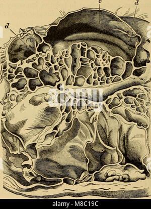 . Diseases of women. A clinical guide to their diagnosis and treatment ...