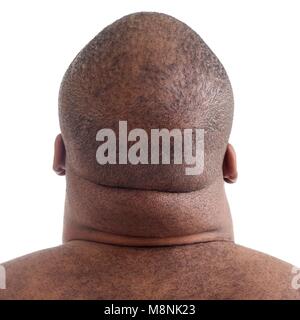 rear view close up of obese thighs Stock Photo - Alamy