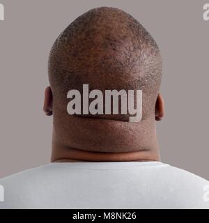 Close up of overweight man's neck, rear view Stock Photo - Alamy