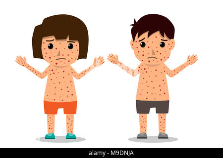 Children has chicken pox infographic, Poster children fever and ...