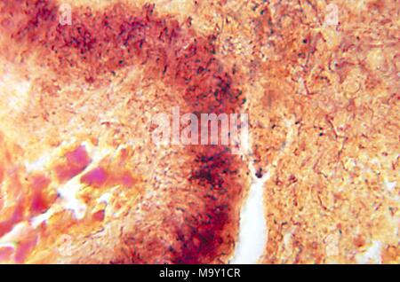 Light micrograph of the rod-shaped bacteria Bacillus anthracis, cause ...