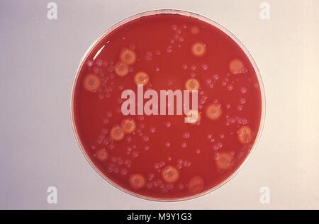 blood agar culture plate growing Bacillus anthracis (anthrax Stock ...