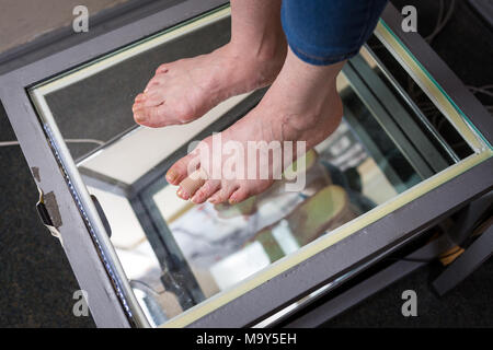 Step Digital Foot Scan, Orthotics Foot Scan for Custom Made Shoe ...