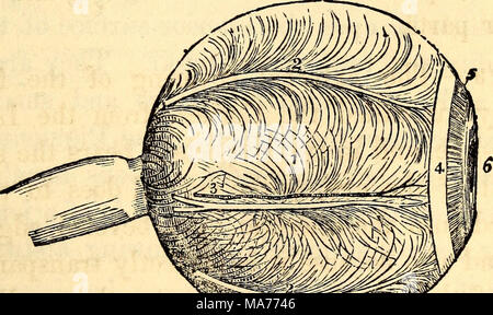 Choroid Coat and Iris Stock Photo - Alamy