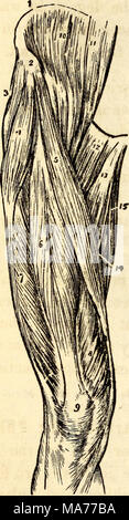 Thigh muscle anatomy. Anterior view of some of the layers of the ...