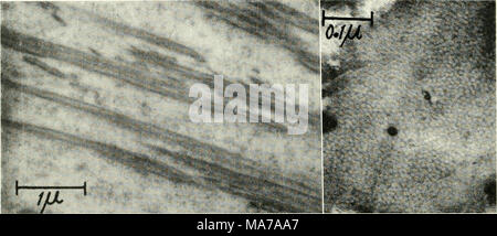 High magnification light micrograph showing heart myocytes ...
