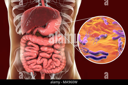 Helicobacter Pylori in the Human Stomach Viewed at 400x Magnification ...