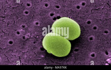 Staphylococcus Epidermidis Bacteria, SEM Stock Photo - Alamy