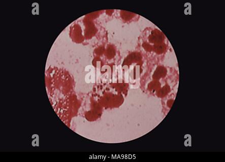 Gram-negative Neisseria gonorrhoeae bacteria revealed in a transmission ...