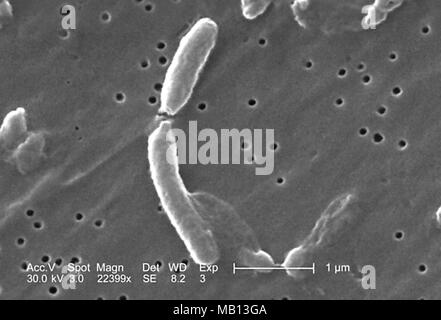Vibrio cholerae bacteria revealed in the 22371x magnified scanning ...