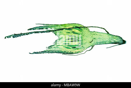 Light photomicrograph of Moss protonemata whole mount seen through ...