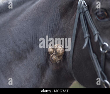 Papilloma wart virus infection Stock Photo - Alamy
