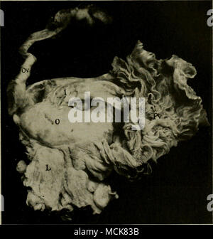 . Fig. 155 —Adherent Ovary. Cow. Dorsal surface viewed from behind. L ...