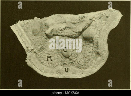 . Fig. 184—Pyometra with Granular Mucosa. U, Uterine wall ; JM, mucosa ...