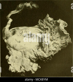 . Fig. 155 —Adherent Ovary. Cow. Dorsal surface viewed from behind. L ...